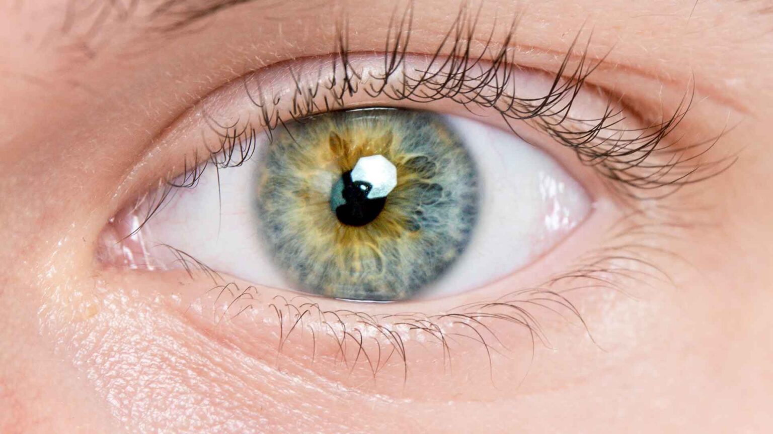 From Dull to Dazzling: Natural Ways to Whiten Your Eyes