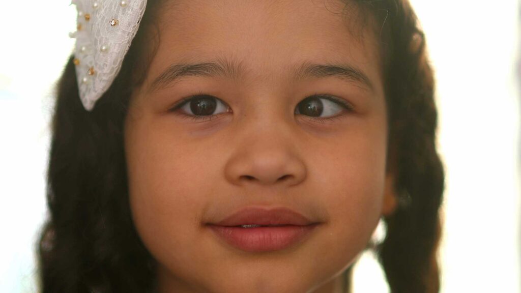 Lazy Eye and Laser Surgery: Separating Fact from Fiction