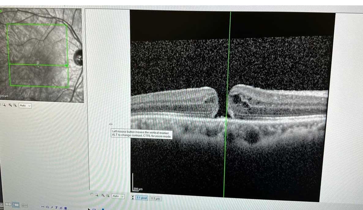 AI Meets OCT: Revolutionising Eye Care on Harley Street