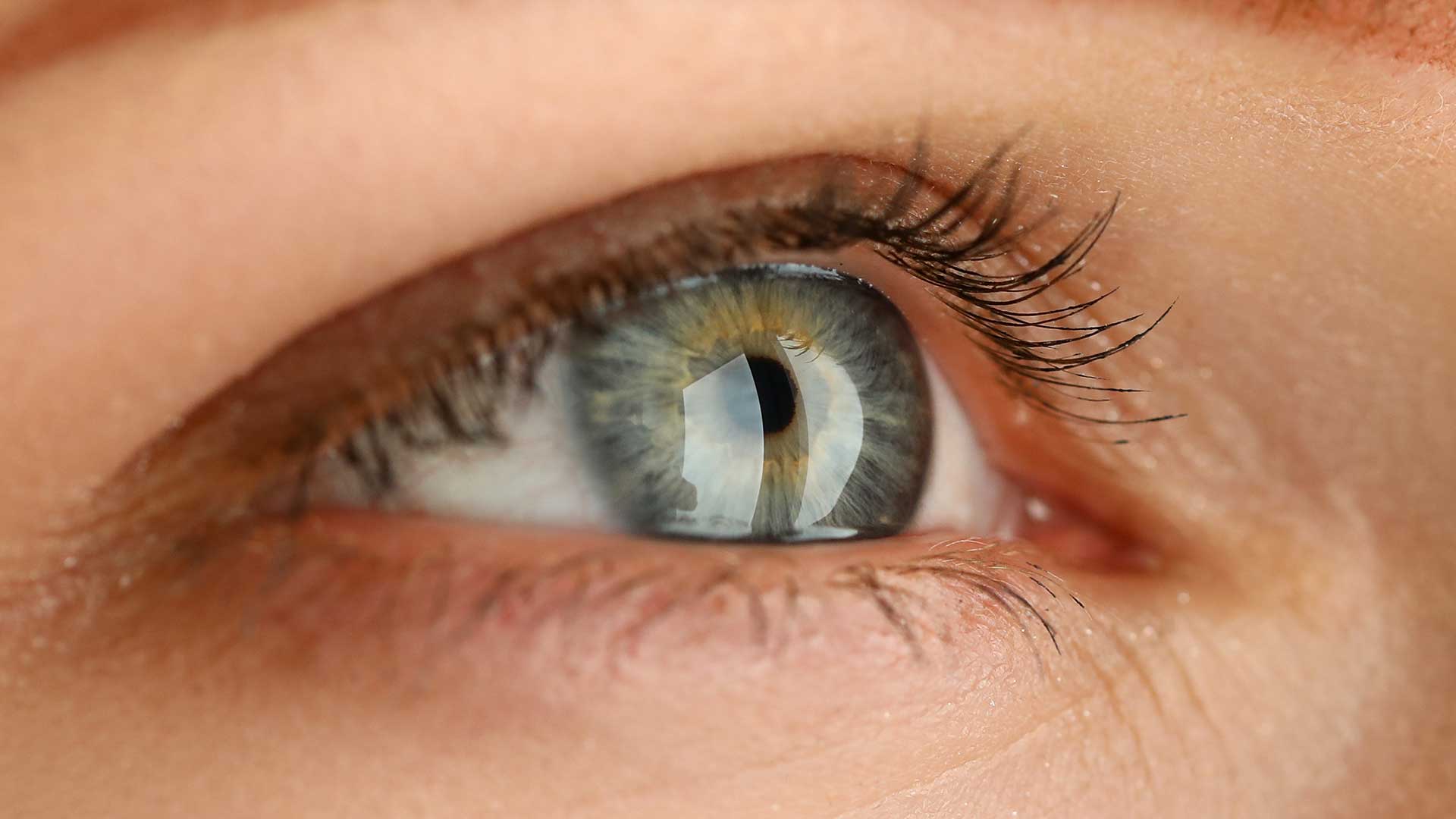 London's Premier ICL Surgery: Blue Fin Vision®