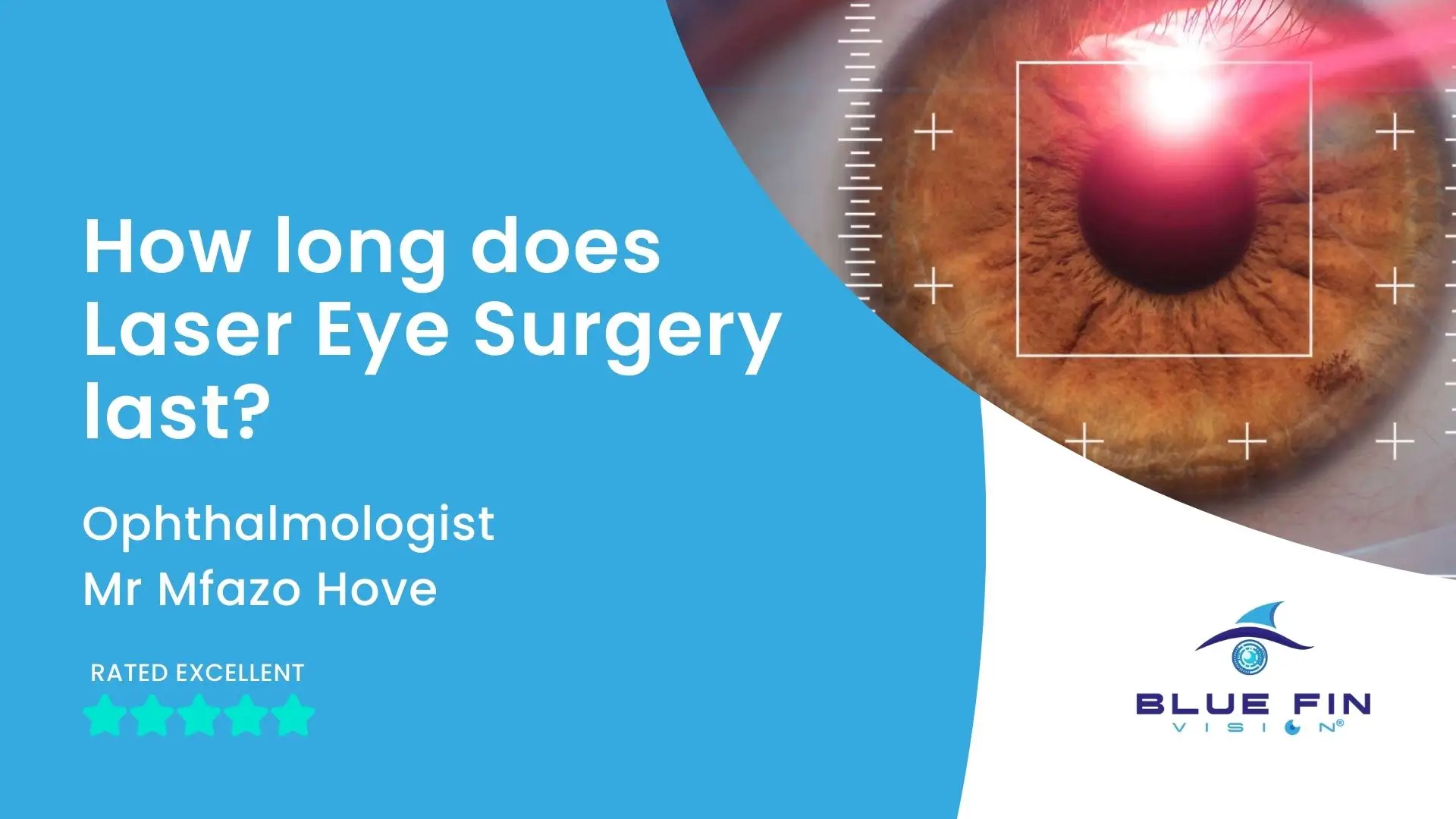 How Long Does Laser Eye Surgery Last?