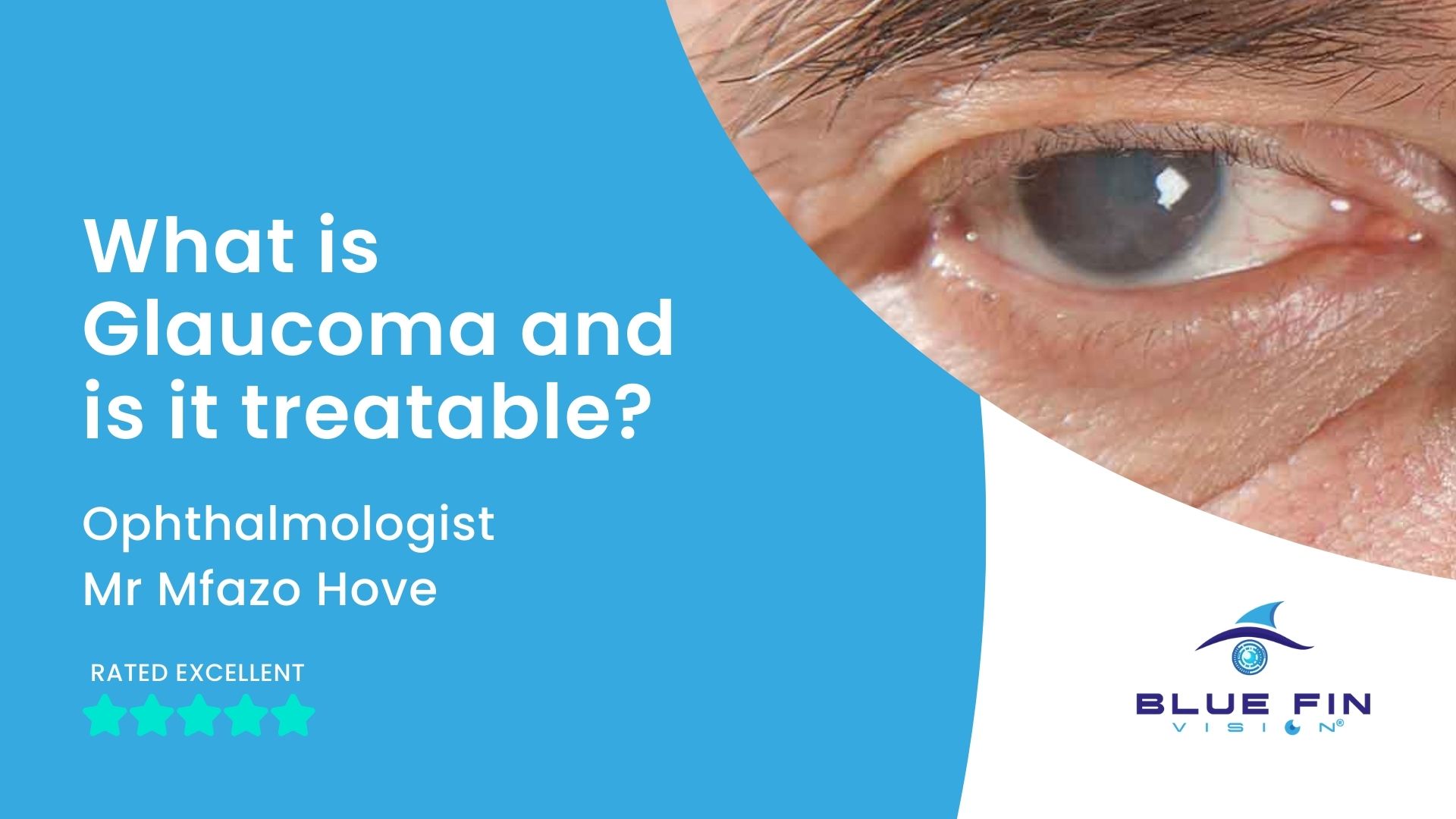 Blue Fin Vision® | What is Glaucoma and is it treatable?
