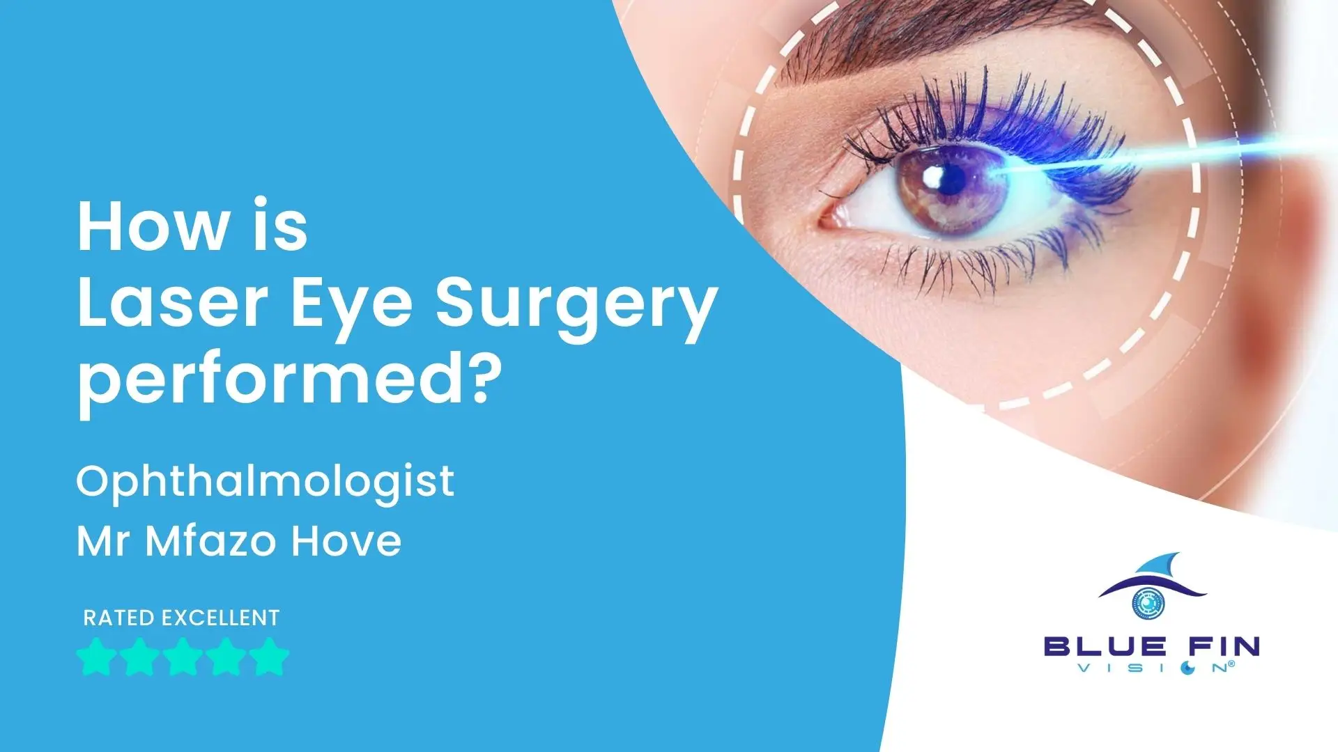 How Laser Eye Surgery Is Performed?